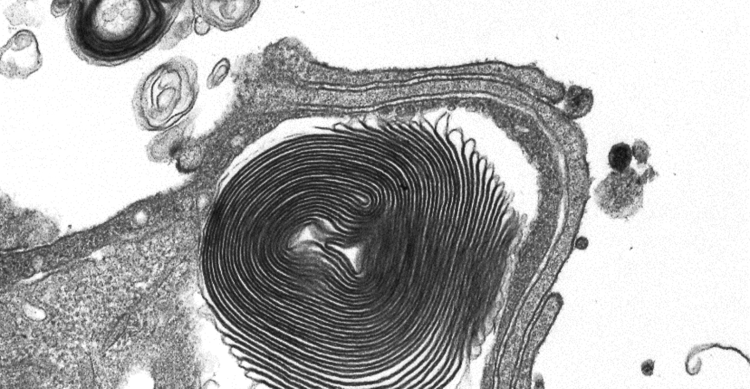 Cell Adhesion Structures,TEM | Cell Structure Lab