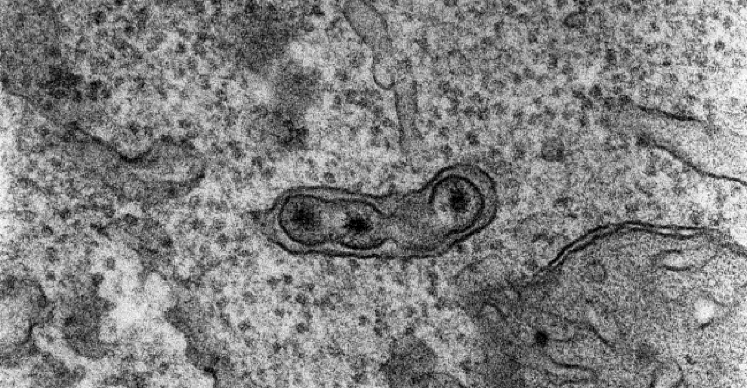 Retrovirus, Ultrathin Section and TEM | Cell Structure Lab