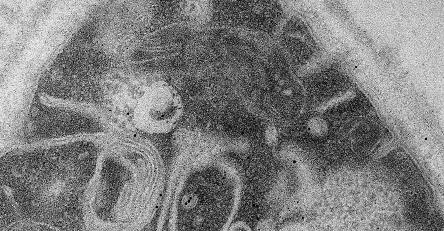 Yeast Cell, Immunogold Labeling | Cell Structure Lab